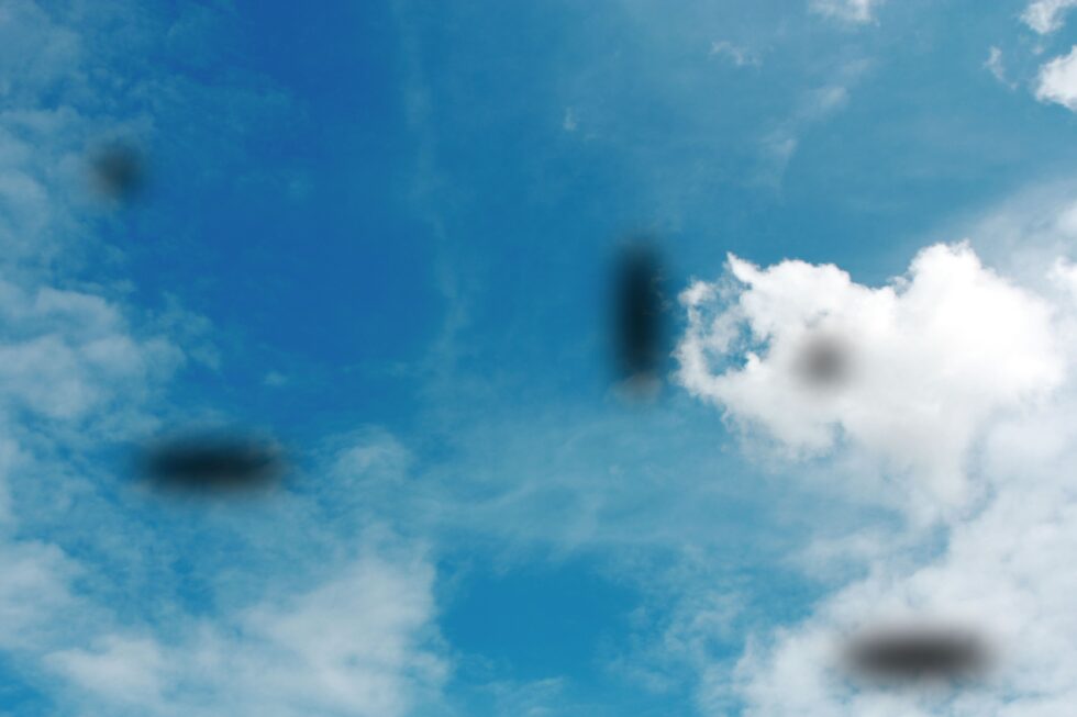 The Science Behind Eye Floaters | Medical Eye Specialists